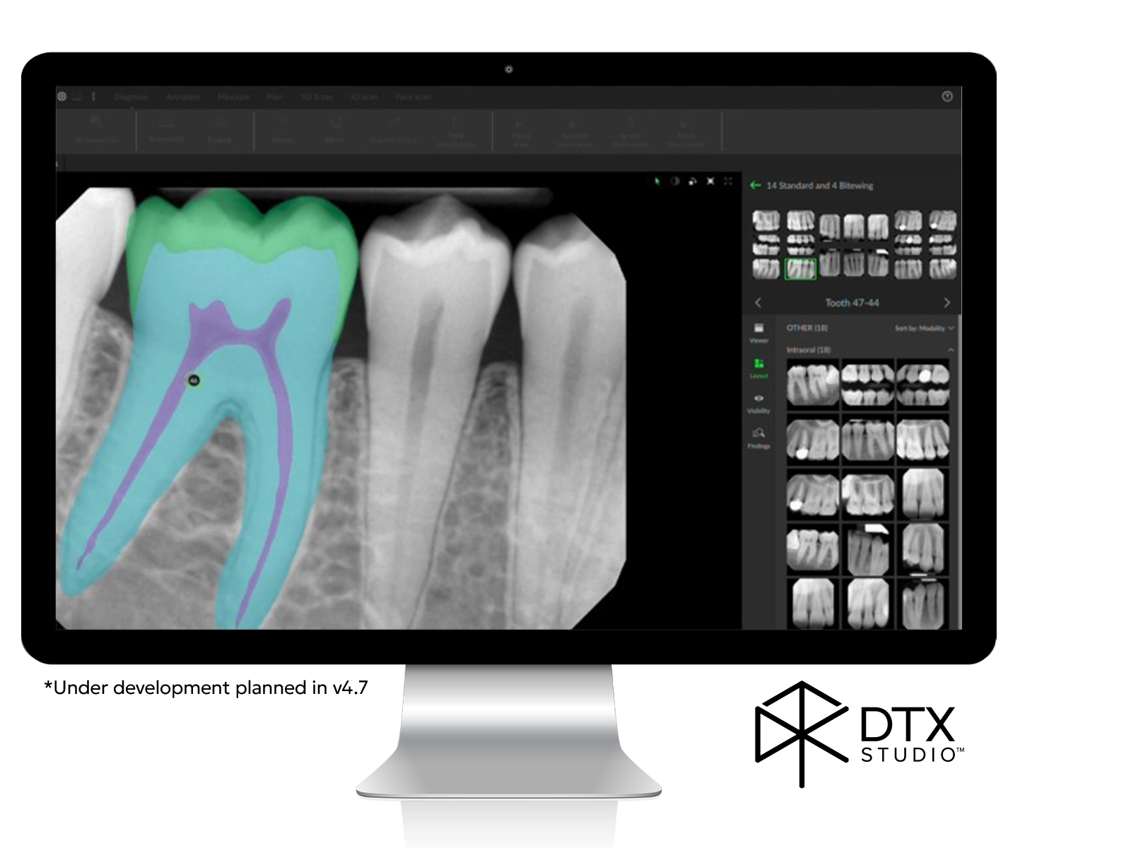 DTX Studio Clinic – AI platforma pro 2D/3D zobrazování - Smrček Dental